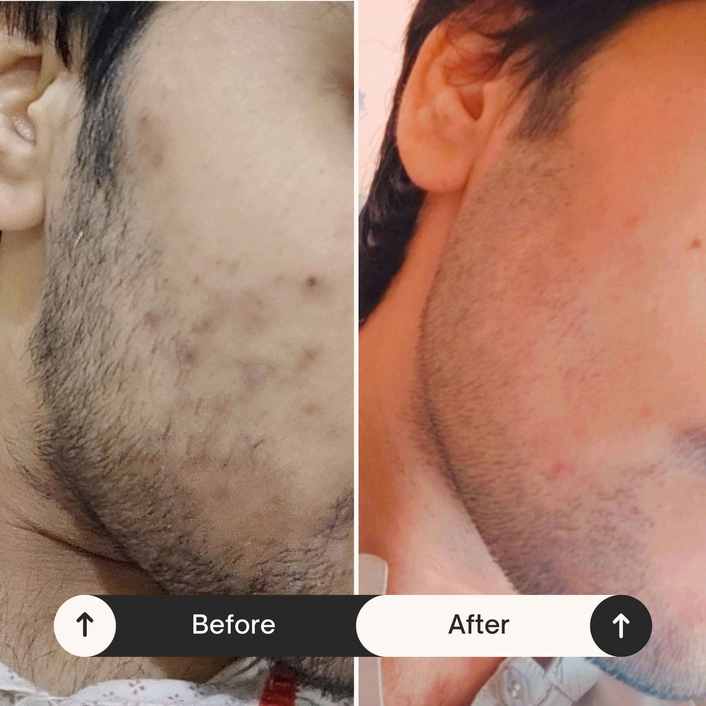 Zentox Detox - Skin, Gut & Liver Detoxifier